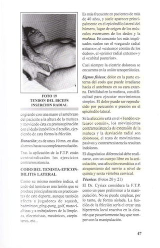 Cyriax masaje-transverso-profundo | PDF