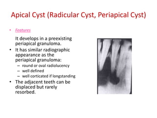 Cyst | PPT