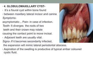 Cyst of oral and maxillofacial regions | PPTX