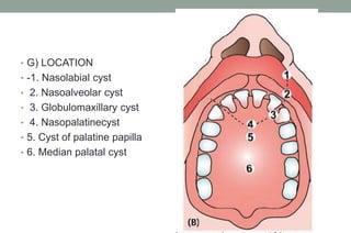 Cyst of oral and maxillofacial regions | PPTX