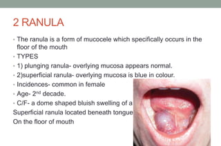 Cyst of oral and maxillofacial regions | PPT