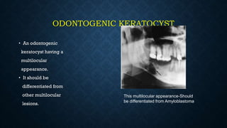 CYSTS OF THE ORAL CAVITY A Cyst is a benign pathologic cavity filled ...