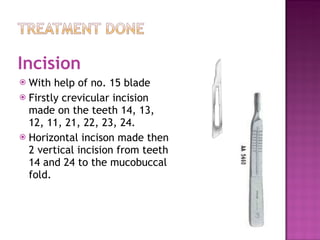Cyst enucleation by Dr. Anuja Aggarwal | PPT