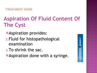 Cyst enucleation by Dr. Anuja Aggarwal | PPT