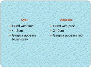 Periodontology Cyst | PPTX