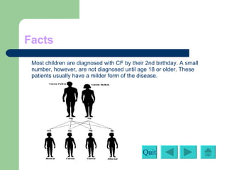 Cystic Fibrosis | PPT