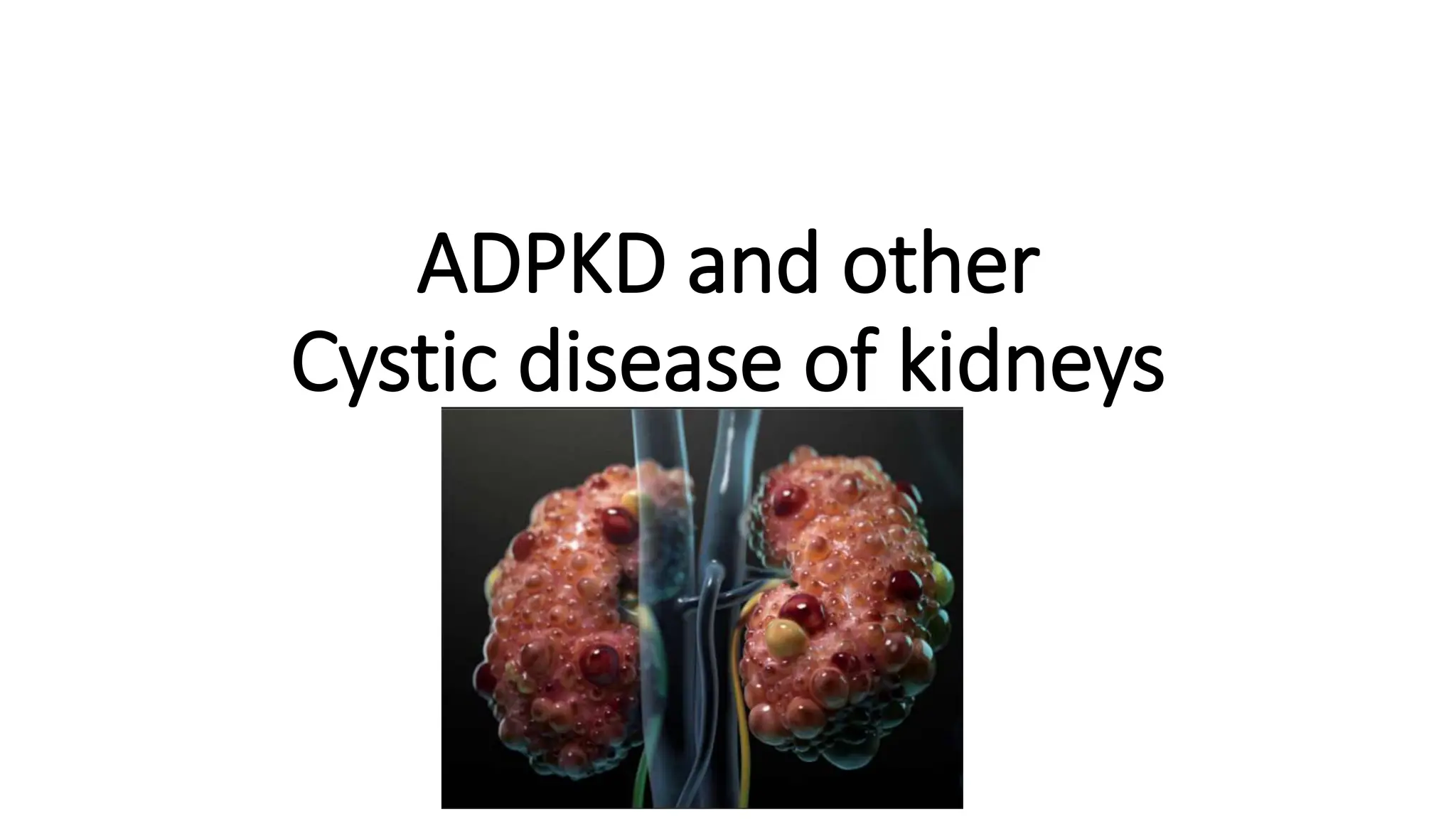 cystic disease of kidney- Adult polycystic Kidney.pptx