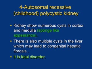 Cystic diseases of kidney | PPT