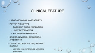 Cystic diseases of kidney | PPT