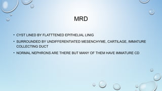 Cystic diseases of kidney | PPT