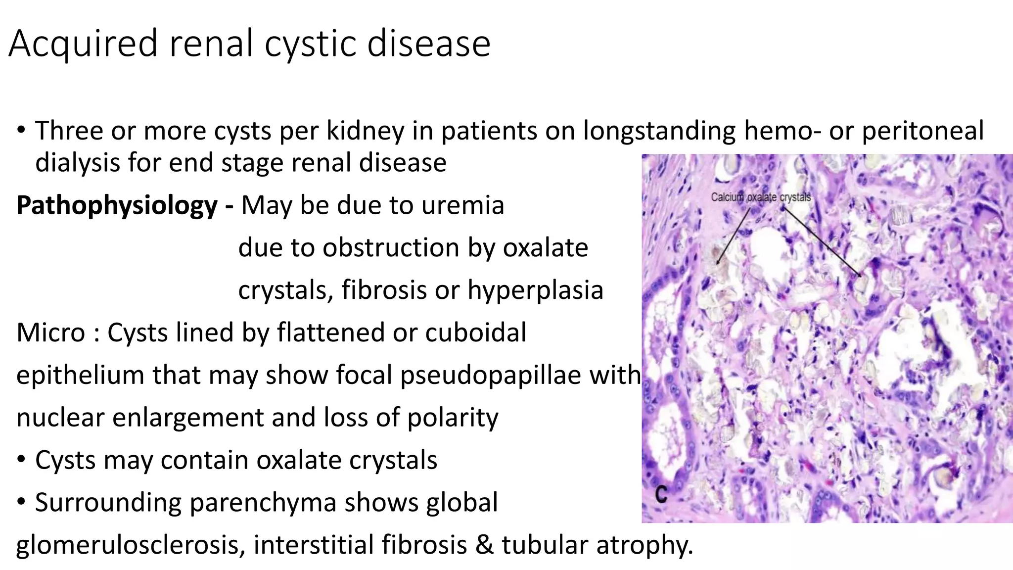 Cystic diseases of kidney | PPTX