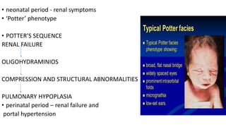Cystic diseases of kidney | PPTX