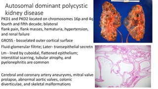Cystic diseases of kidney | PPTX