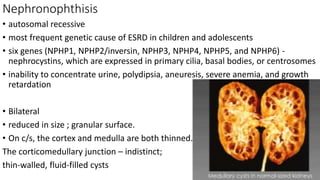 Cystic diseases of kidney | PPTX