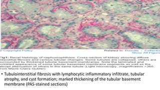 Cystic diseases of kidney | PPTX
