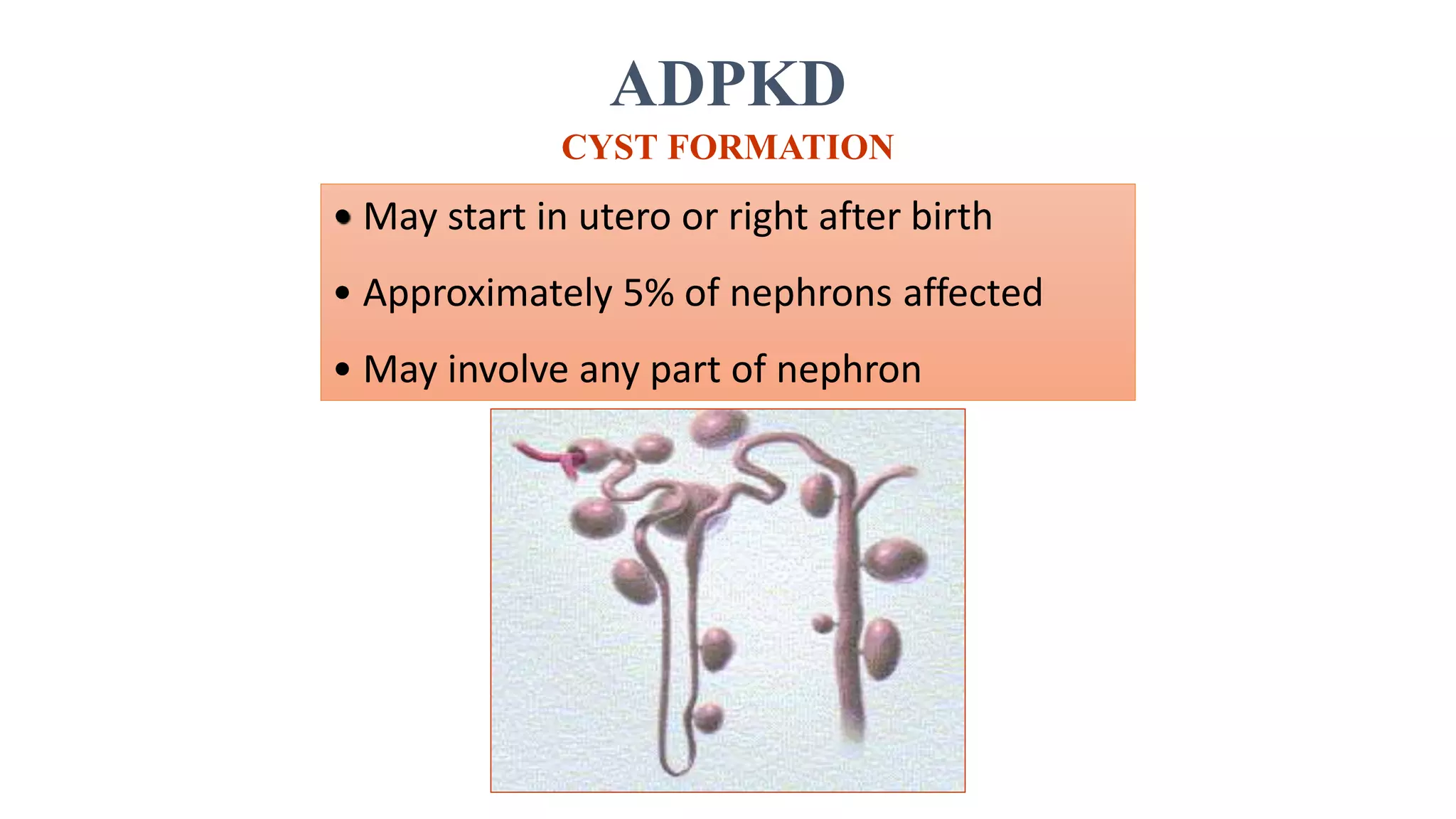 Cystic diseases of kidney | PPTX