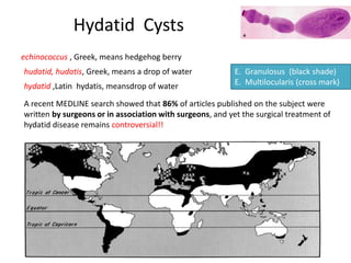 Cystic diseases of liver | PPTX