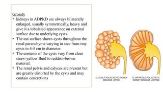 Cystic diseases of the kidney.pptx present | PPTX