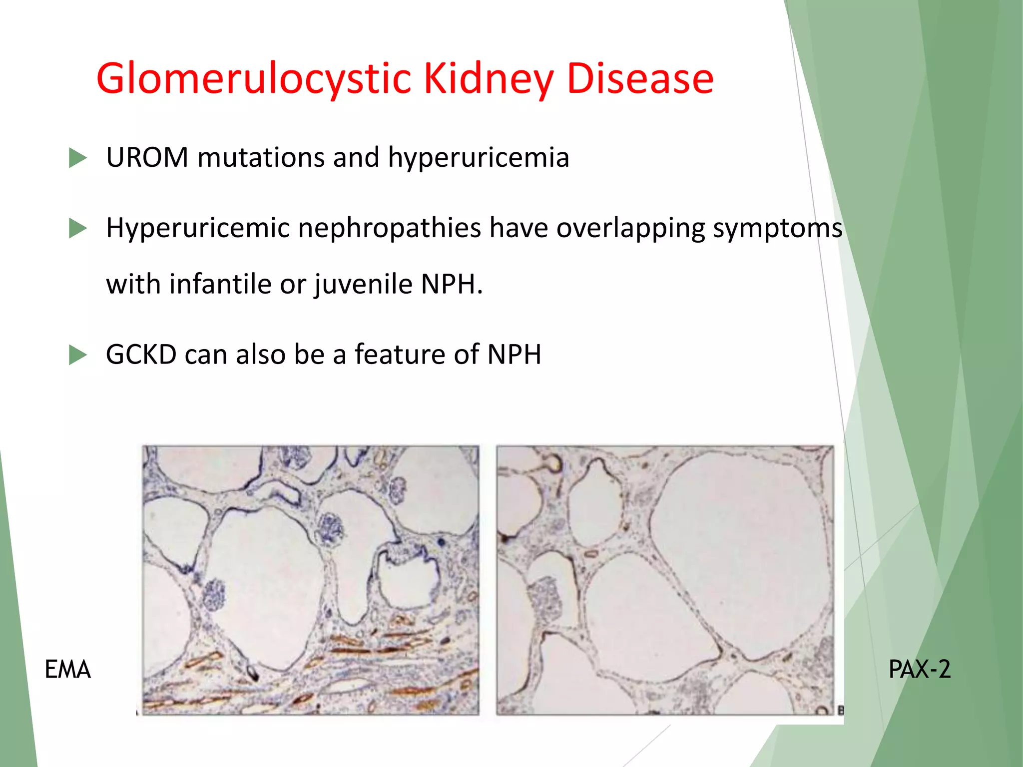 Cystic diseases of kidney | PPTX