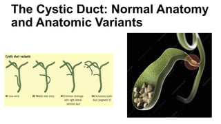 Cystic Duct Normal Anatomy and Anatomic Variants.pptx