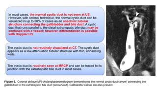 Cystic Duct Normal Anatomy and Anatomic Variants.pptx