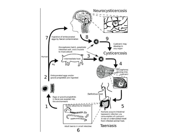 Cysticercosis diagnosis & management.pptx