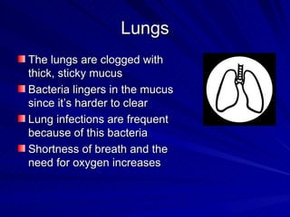 Cystic Fibrosis | PPT | Lung and Respiratory Health | Diseases and ...