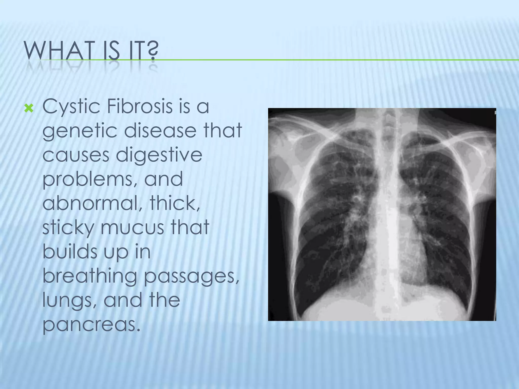 Cystic Fibrosis | PPTX