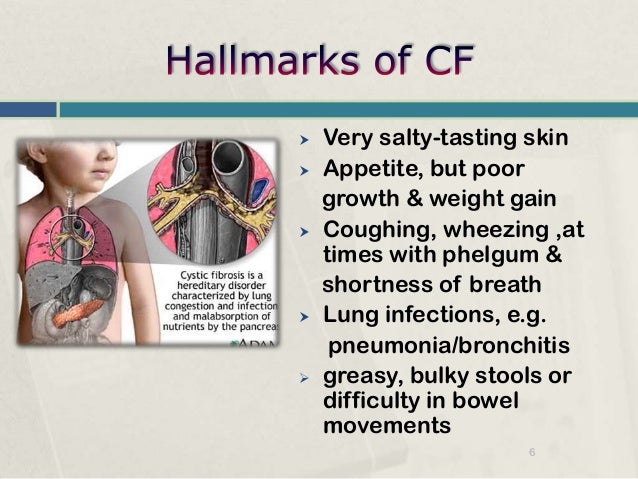 Yellow Stool Cystic Fibrosis