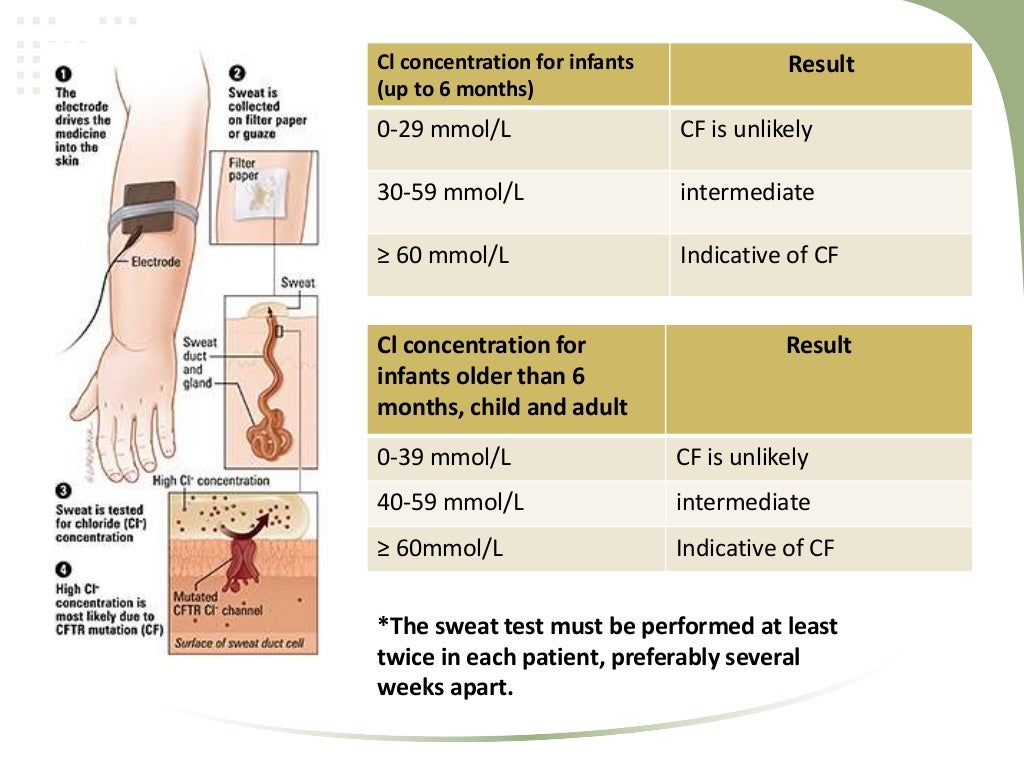 Paediatric Cystic Fibrosis
