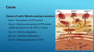 Cystic fibrosis | PPTX | Lung and Respiratory Health | Diseases and ...