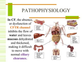 CYSTIC FIBROSIS | PDF