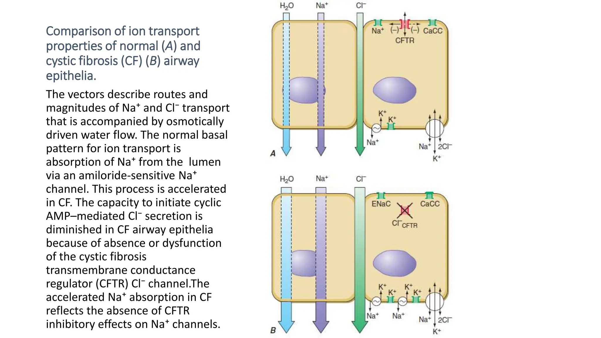 CYSTIC FIBROSIS.pptx for medical students | PPTX