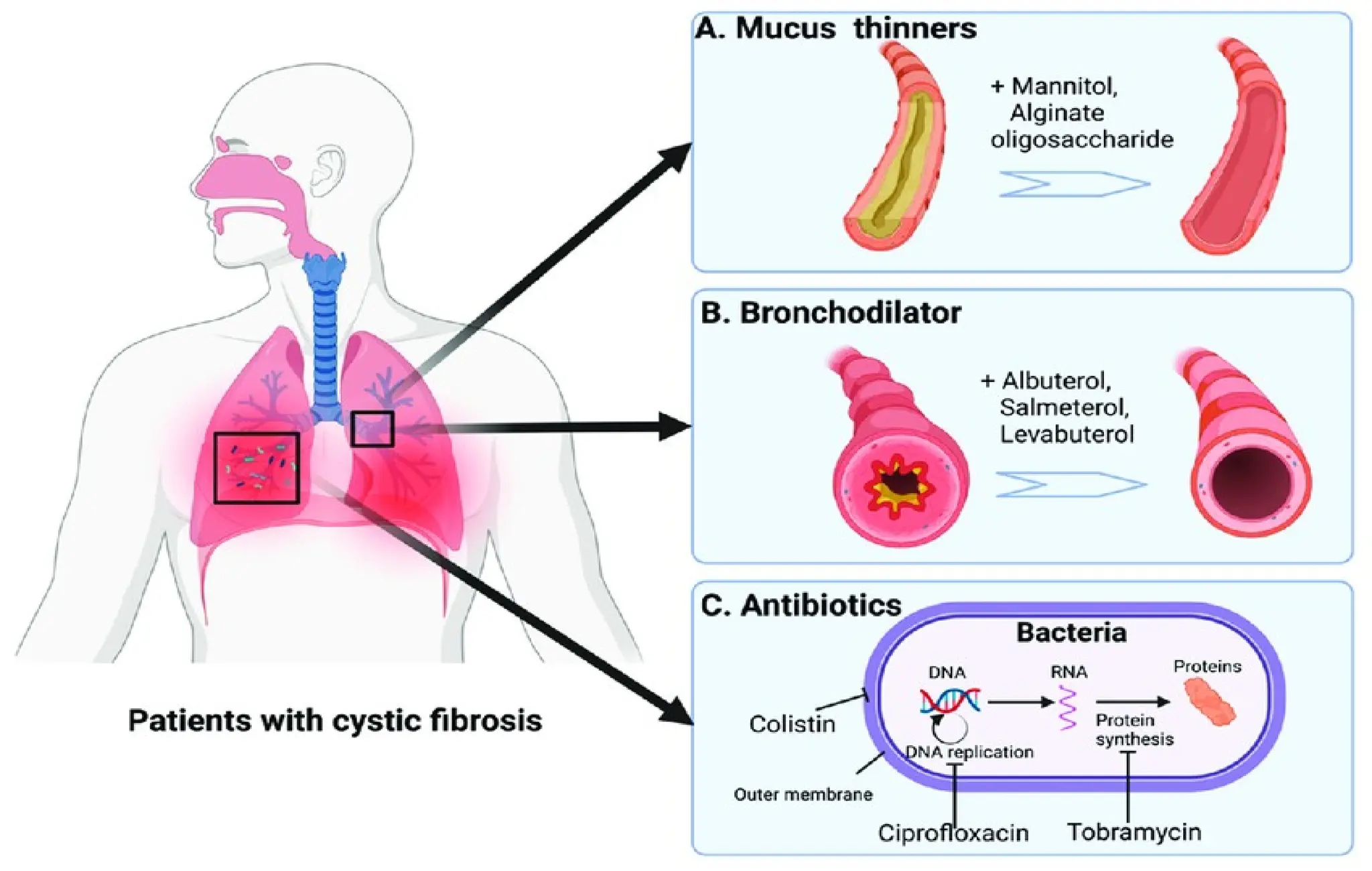 CYSTIC FIBROSIS - TYPES CAUSES AND FUNCTIONAL CLASSES OF CFTR GENE ...