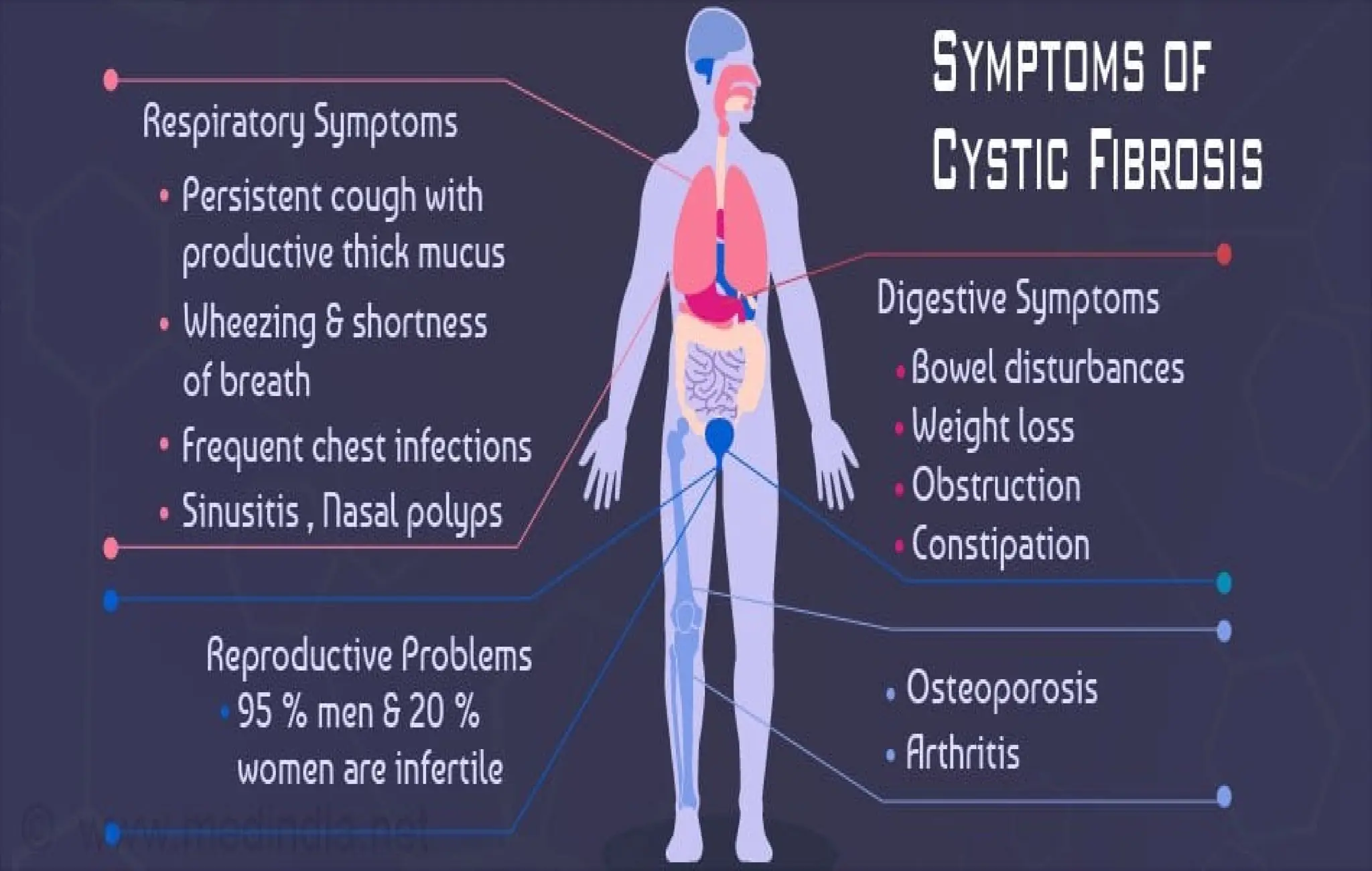 CYSTIC FIBROSIS - TYPES CAUSES AND FUNCTIONAL CLASSES OF CFTR GENE MUTATION | PPT