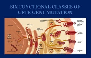 CYSTIC FIBROSIS - TYPES CAUSES AND FUNCTIONAL CLASSES OF CFTR GENE ...
