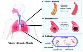 CYSTIC FIBROSIS - TYPES CAUSES AND FUNCTIONAL CLASSES OF CFTR GENE MUTATION | PPT