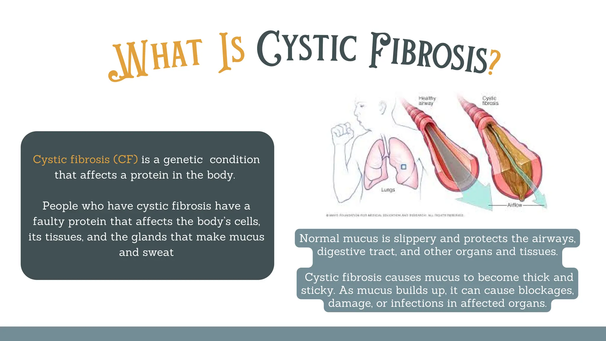 pulmonary cystic Fibrosis presentation ET | PPT