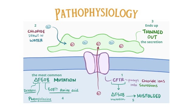 pulmonary cystic Fibrosis presentation ET | PPT