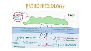pulmonary cystic Fibrosis presentation ET | PDF