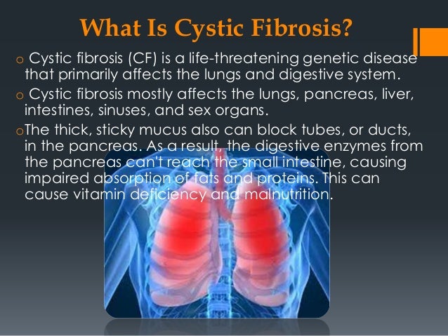 Yellow Stool Cystic Fibrosis