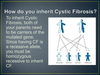 Cystic fibrosis[1] | PPT