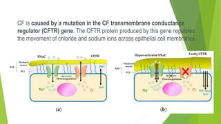 cystic fibrosis 1.pptx