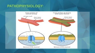 CYSTIC FIBROSIS(1)respiratorysystem (1).pptx