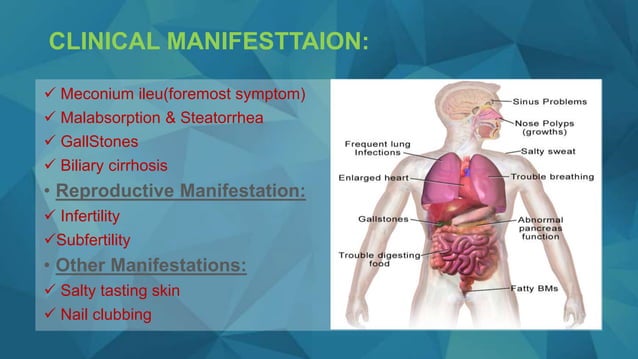 CYSTIC FIBROSIS(1)respiratorysystem (1).pptx