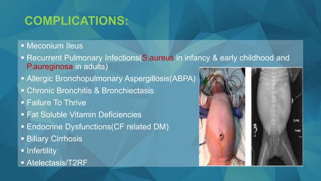 CYSTIC FIBROSIS(1)respiratorysystem (1).pptx