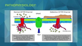 CYSTIC FIBROSIS(1)respiratorysystem (1).pptx