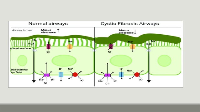 Brief information on cystic fibrosis and genes | PPT