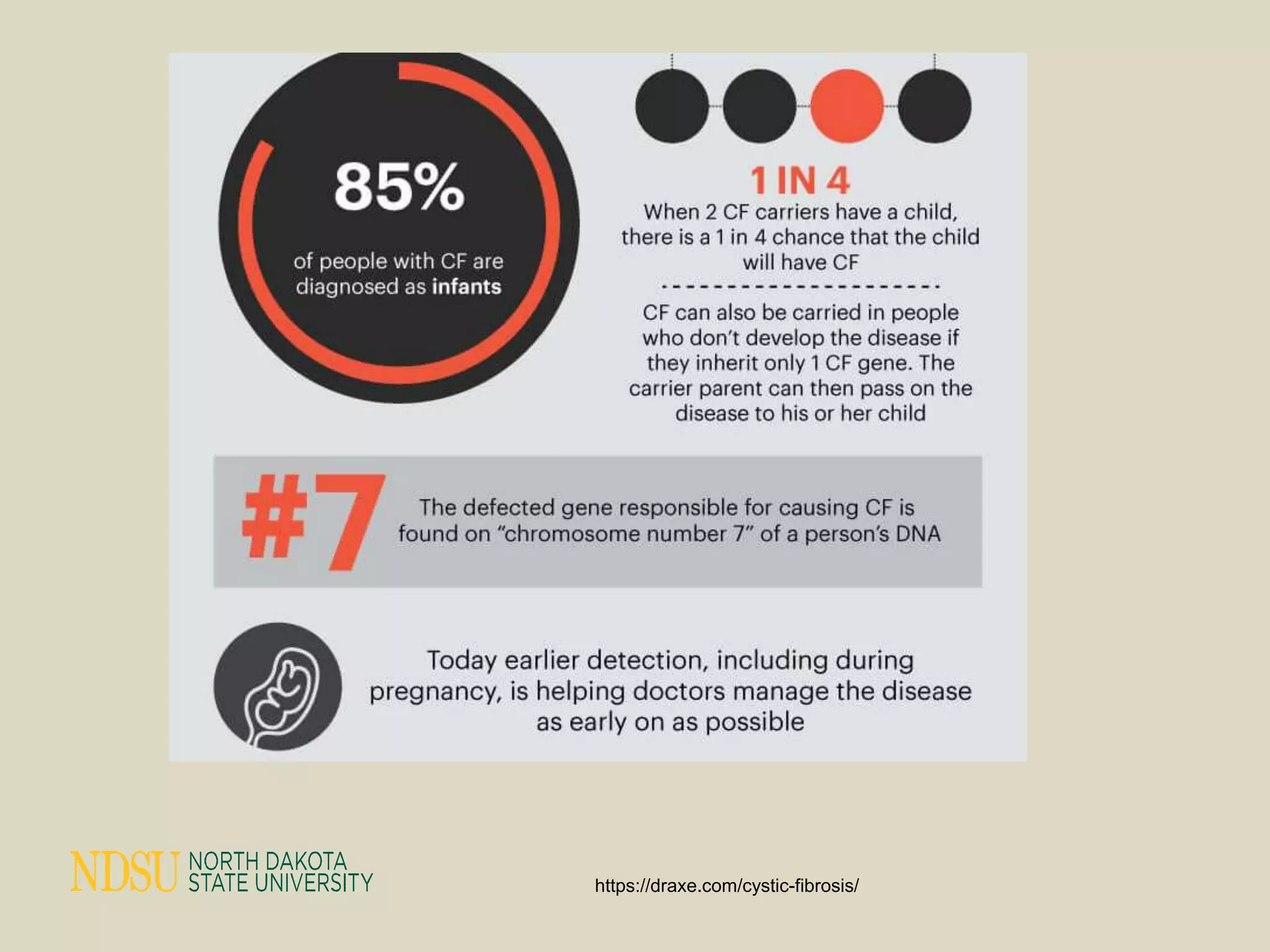 Cystic fibrosis case study | PPTX