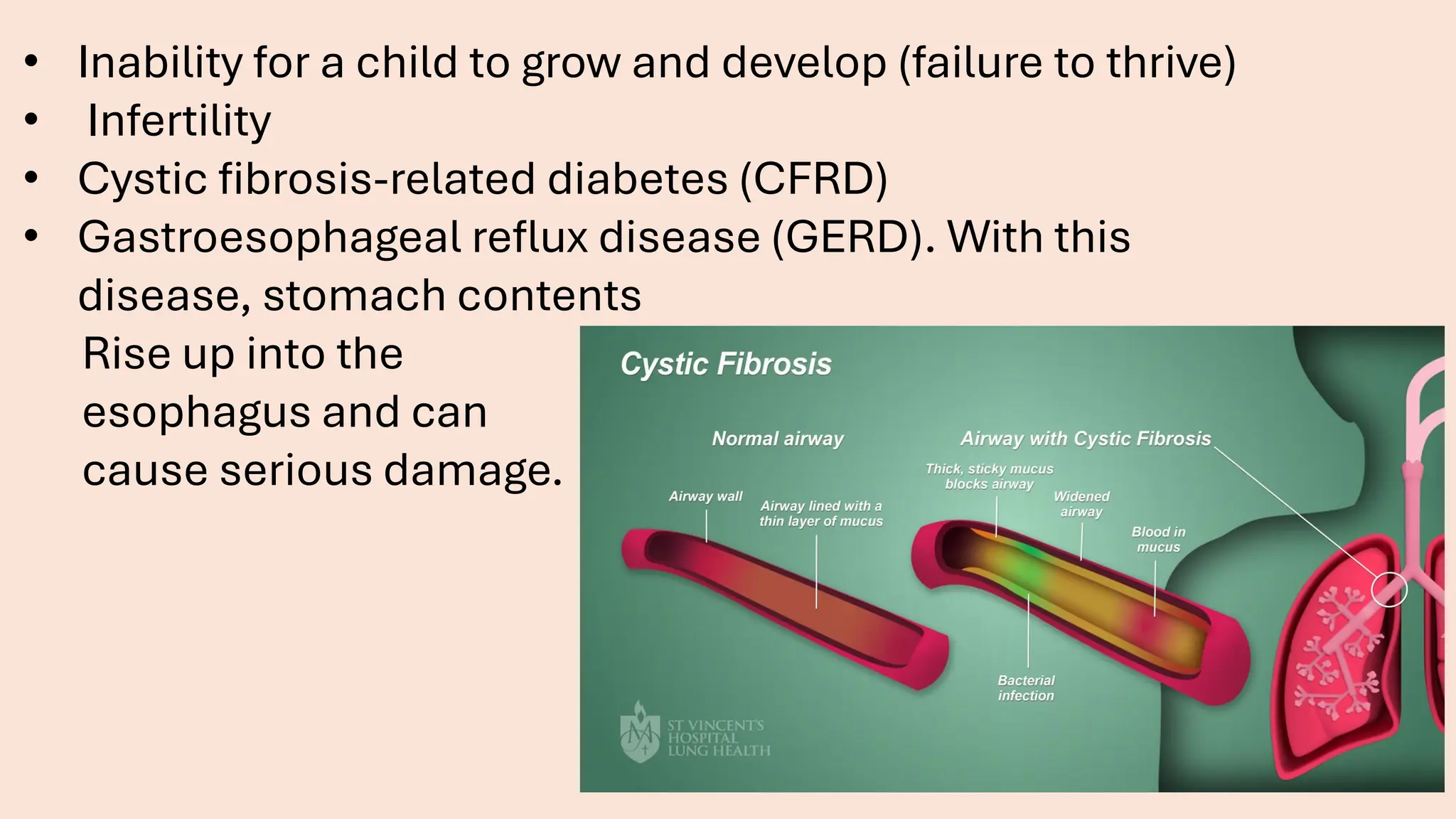 cystic fibrosis:it is a autosomal recessive disease | PDF